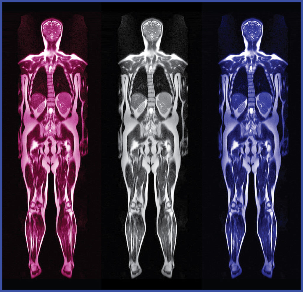 Body Composition Imaging Webinar | Perceptive