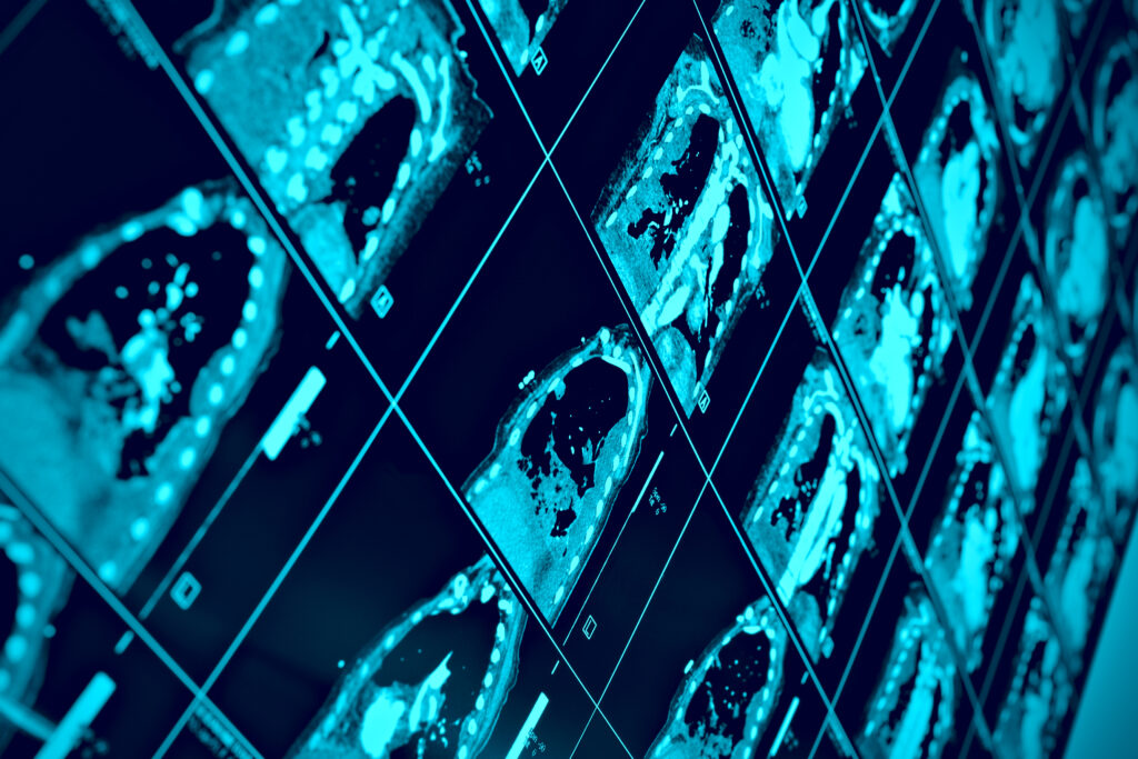 Global Imaging Core Lab for Quality Trials | Perceptive